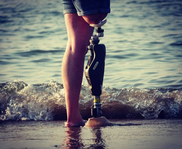 Endo-Exo-Prothesen – Orthopädie-Technik Scharpenberg